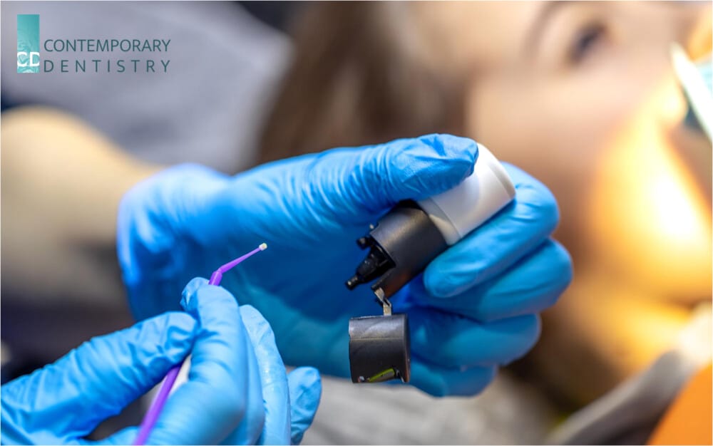 Alternatives to Root Canal Therapy: Your Complete Guide