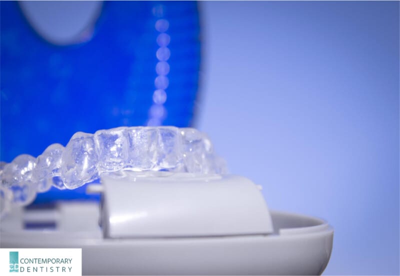 Invisalign Cleaning Crystals | Rochester, NY Guide